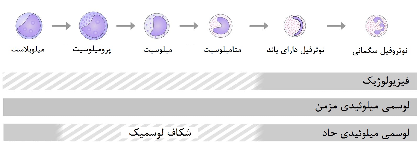 لوسمی حاد